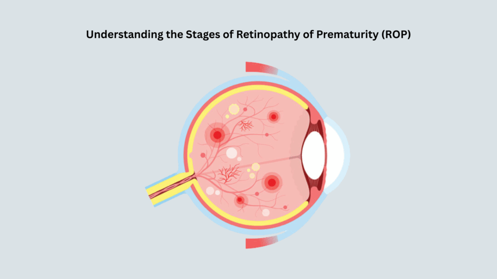 Expert Retina & Vitreous Surgery | Tandon Eye Hospital, Mumbai