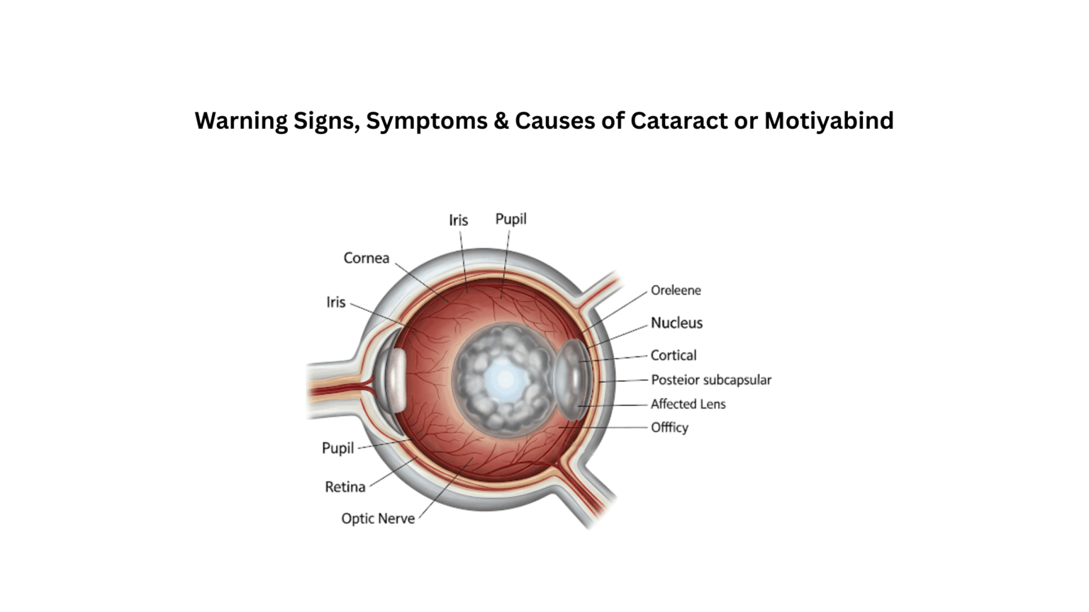 Expert Retina & Vitreous Surgery | Tandon Eye Hospital, Mumbai