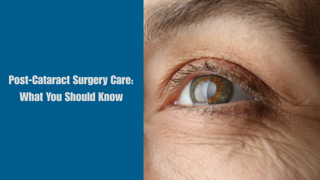 Post-Cataract Surgery Care: What You Should Know
