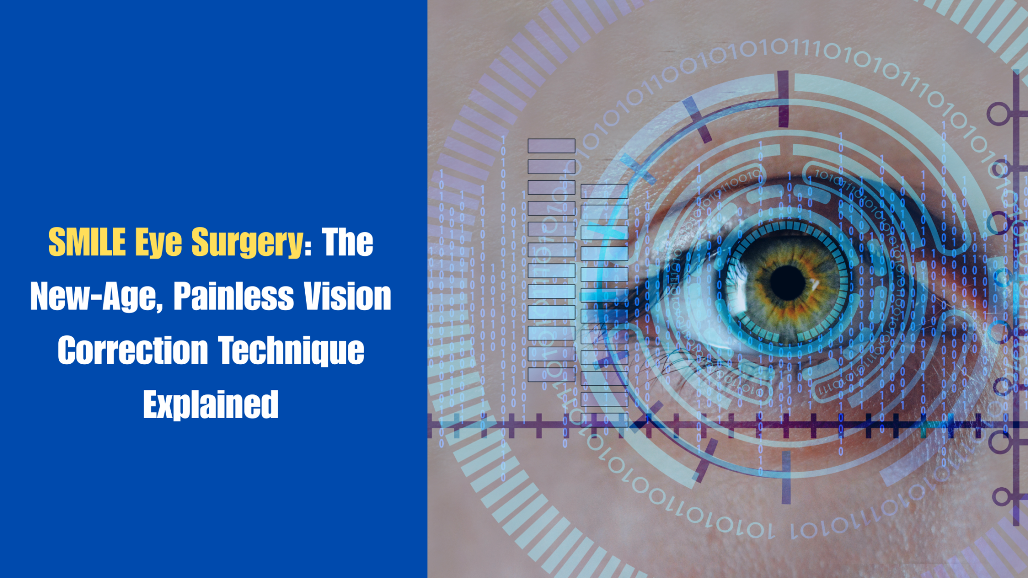 SMILE Eye Surgery: New-Age, Painless Vision Correction